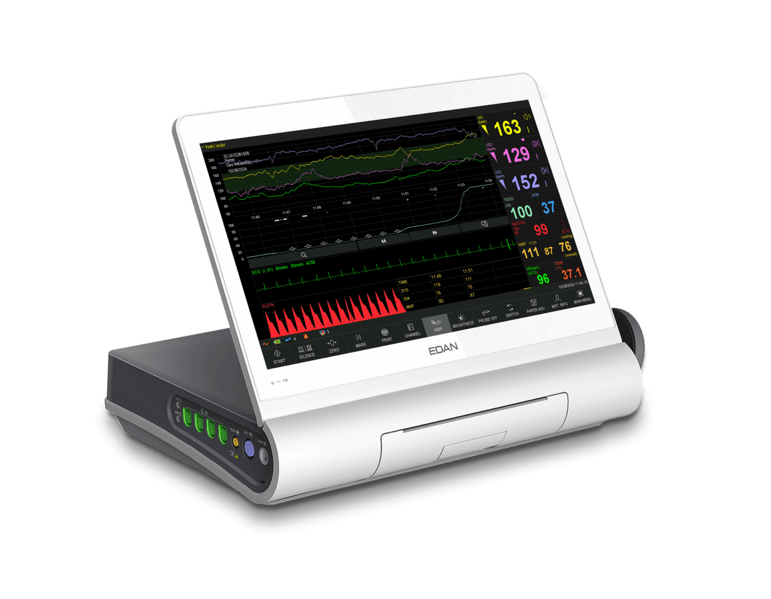 Fetal Monitors - Spectramedx